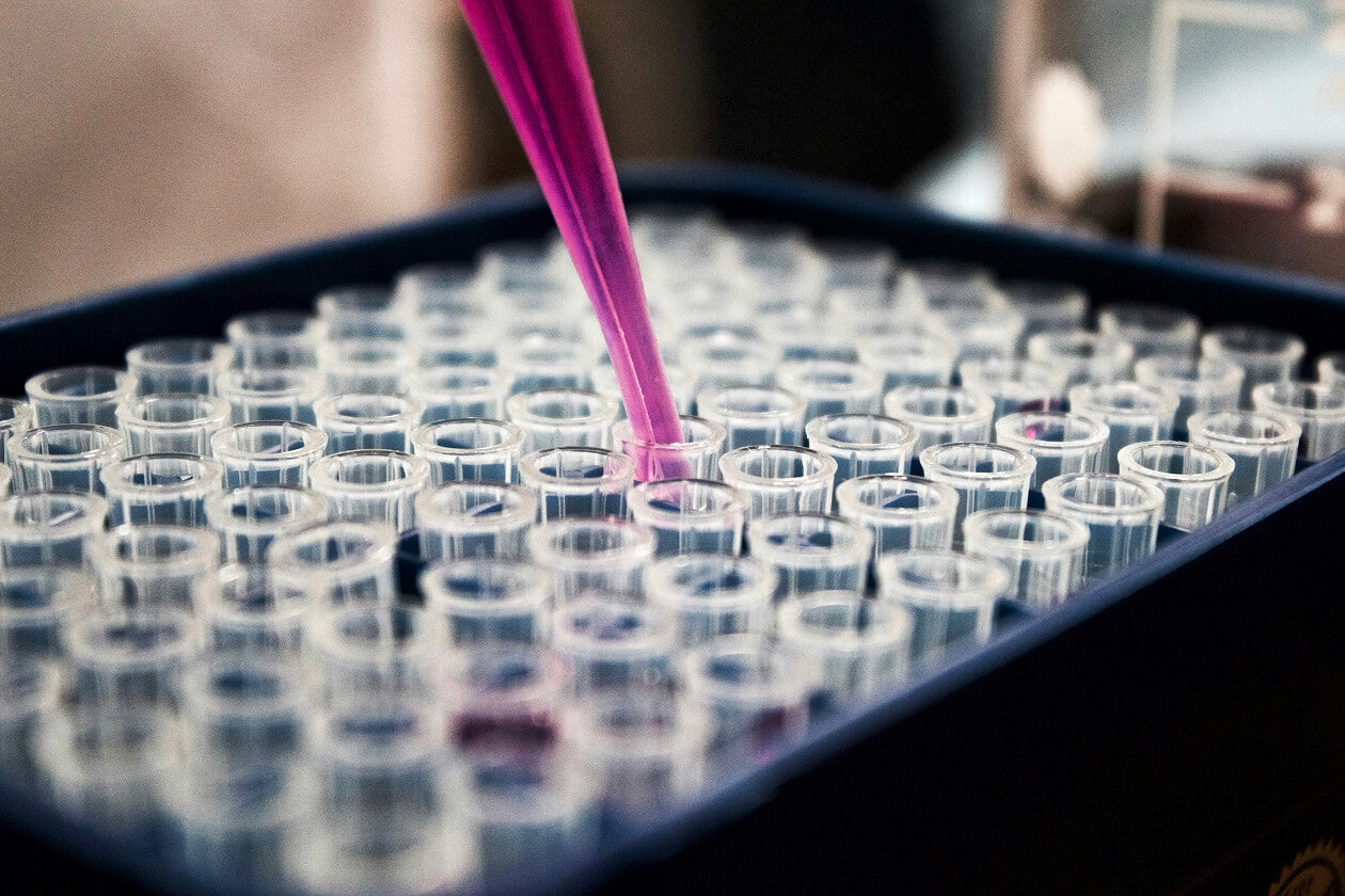 How to Read Blood Test Results: Practical Aussie Guide – Bloody Good