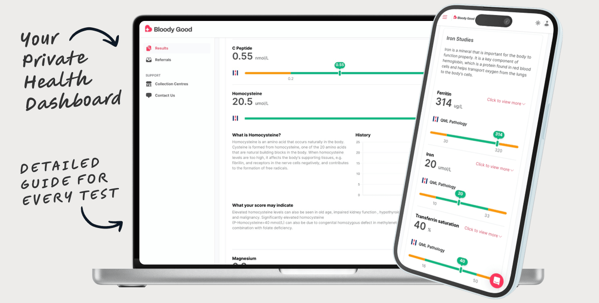 Electrolytes, Urea & Creatinine (EUC) Blood Test – Bloody Good